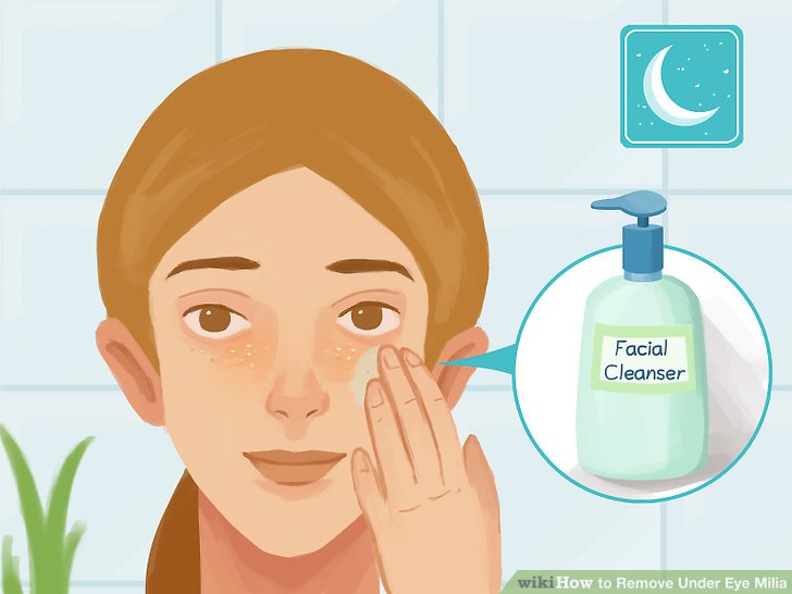 How to Remove Under Eye Milia – Treyolo